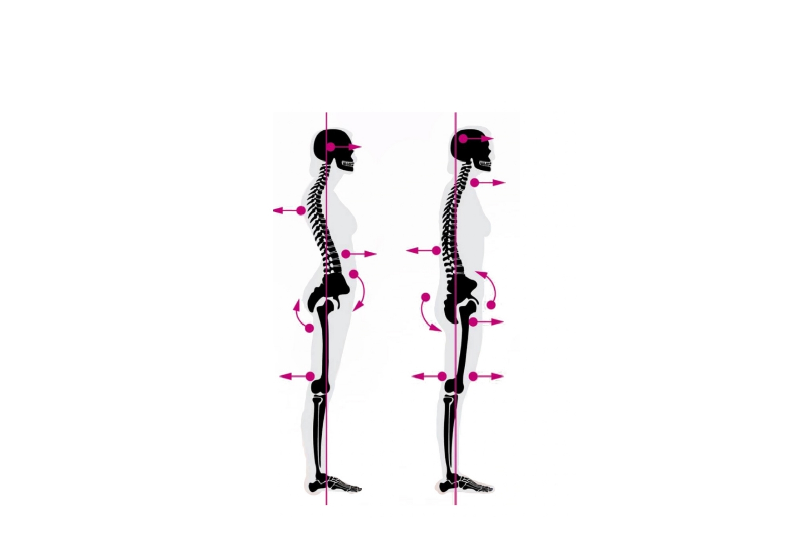 Why How You Stand Matters (And How to Do It Right) - Spine Posture and ...